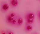 enterobacterien op violet red bile glucose agar